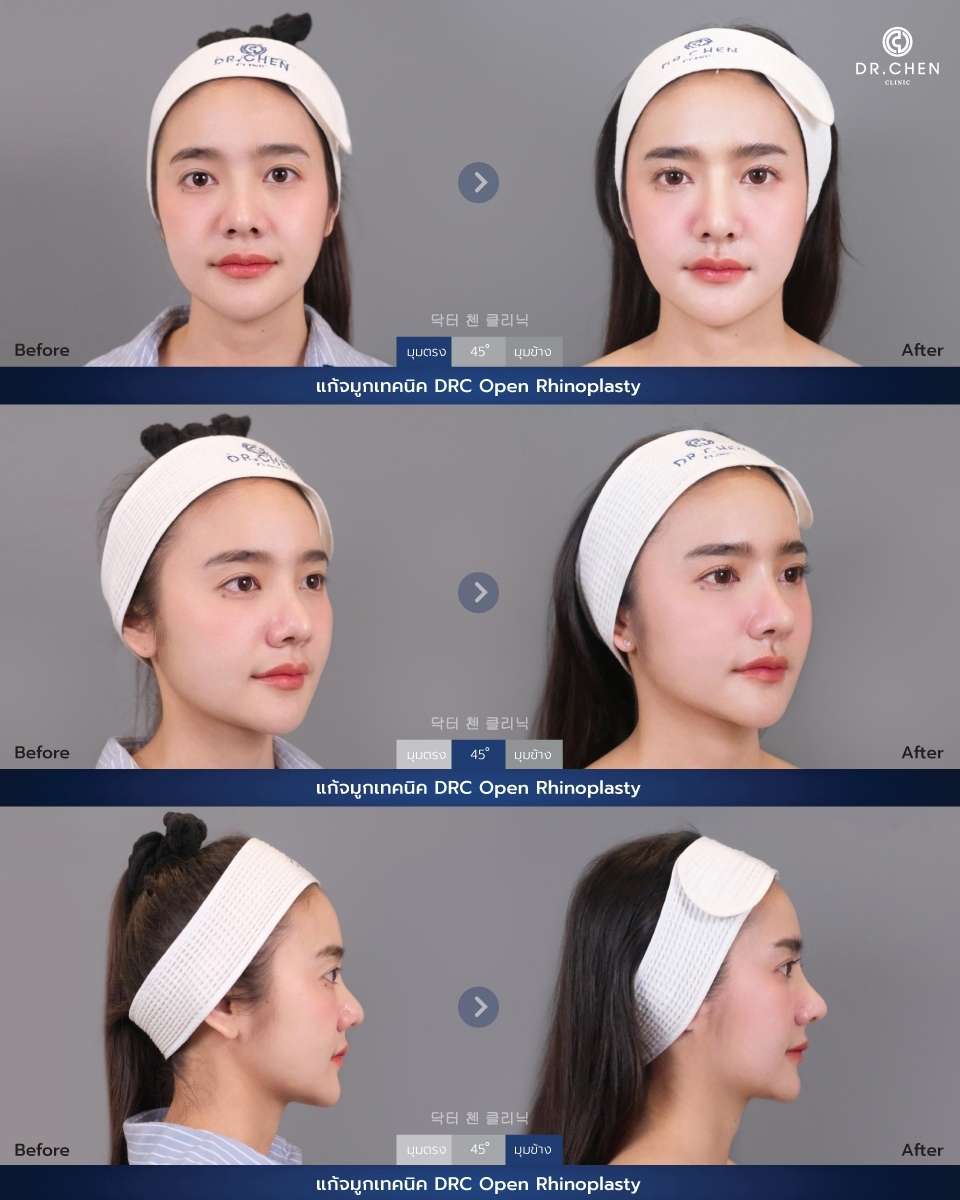 บริการเสริมความงาม ที่ครอบคลุมและตอบโจทย์ความงามทุกแบบ - Dr.CHEN ...