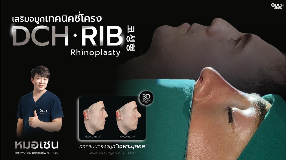 เสริมจมูกซี่โครง ปรับโครงสร้างจมูกให้สวยพุ่งแบบเฉพาะคุณ ที่ DCH ...